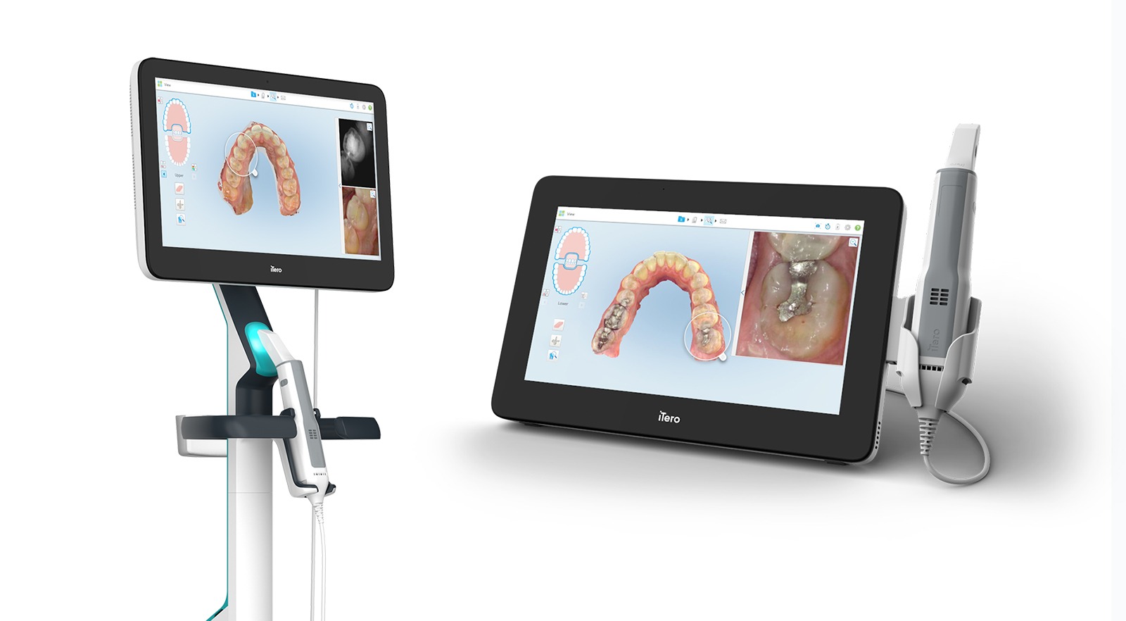 Revolutionary iTero 5D Scanner: Elevating the Experience of Invisalign ...